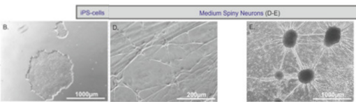 Stem cells as a model for Huntington's disease?