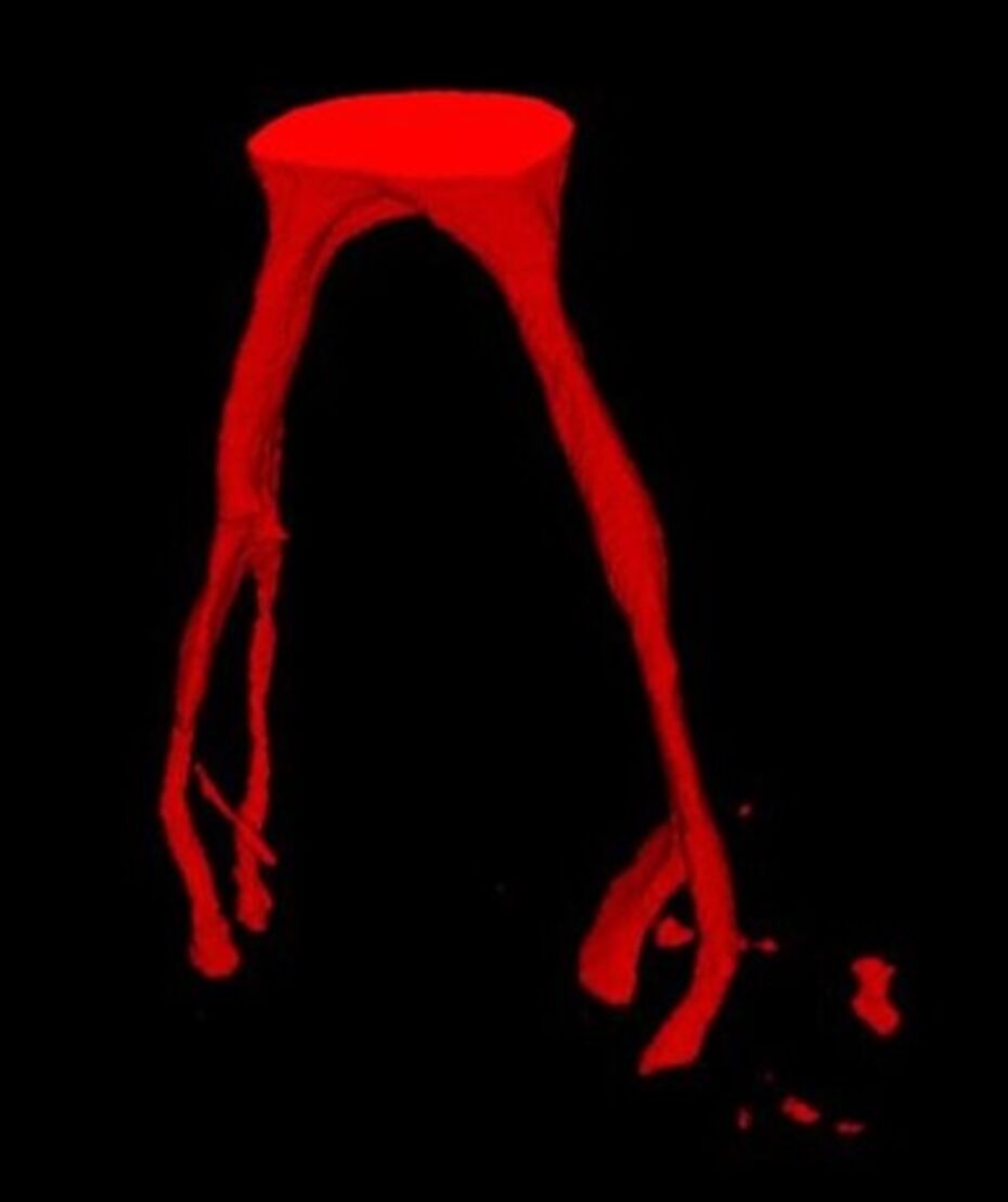 High-resolution 3D Imaging